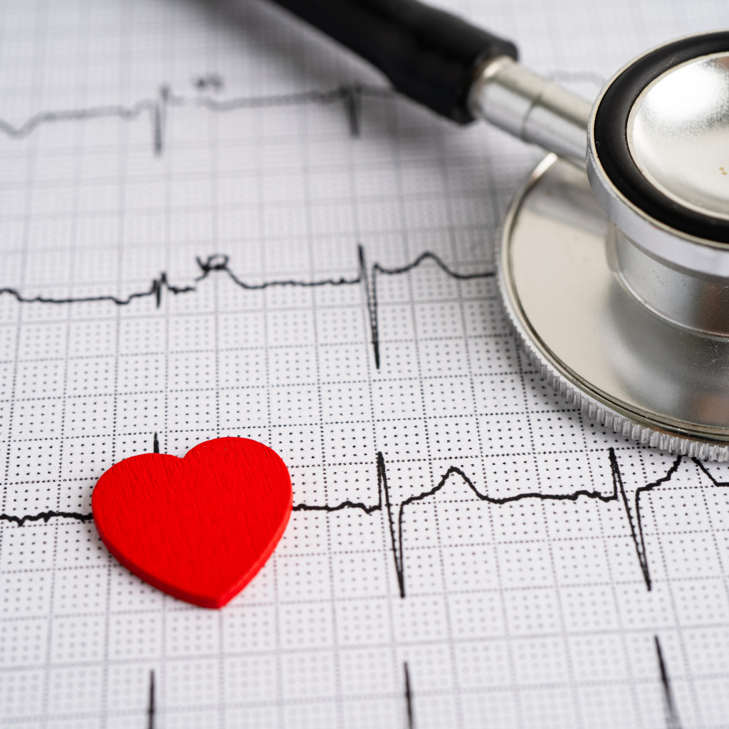 Medical Negligence and Heart Rhythm Disorders: A Legal Perspective ...